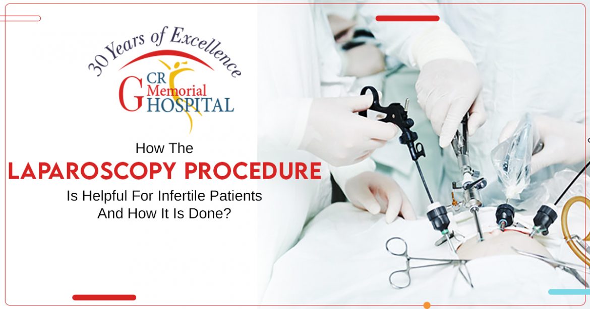 How the laparoscopy procedure is helpful for infertile patients and how ...
